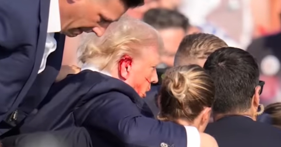 Luka Tembak Ditelinga, Donald Trump Tak Mau Penembak Putuskan Rencananya